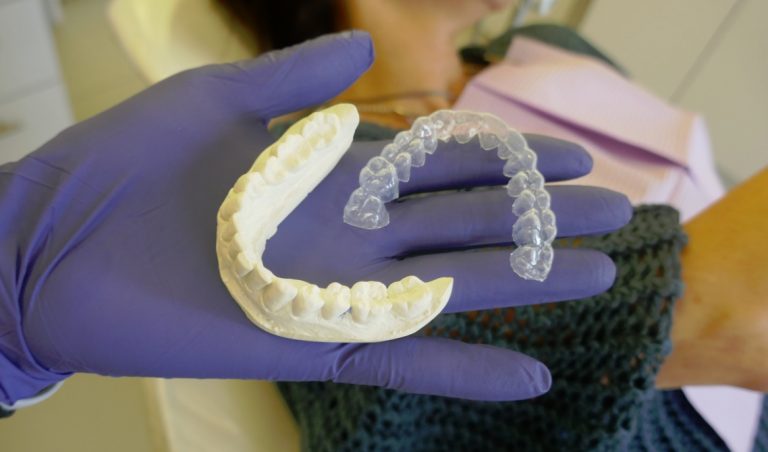 custom-fit-teeth-whitening-trays – Archer Dental